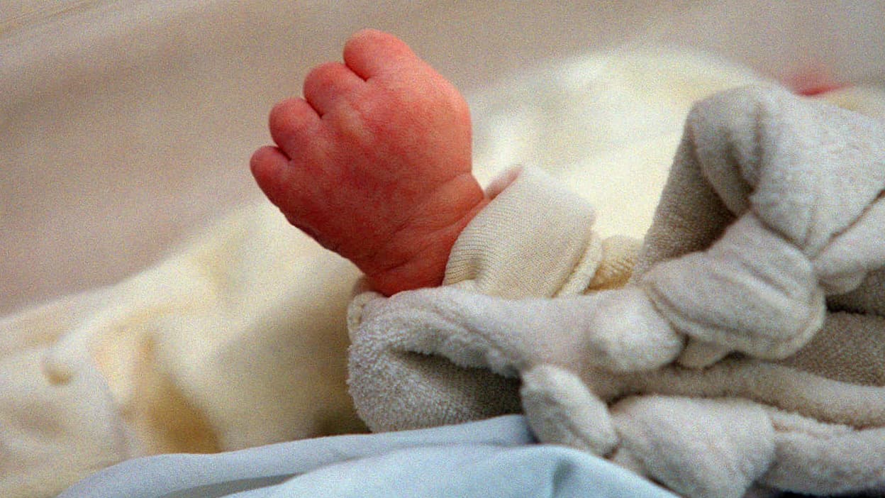Déformations du crâne chez les bébés: la Haute autorité de santé ...