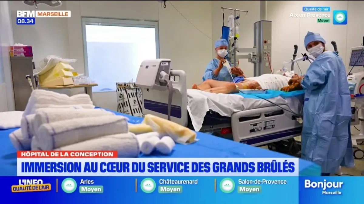 Hôpital de la Conception. Immersion au cœur du service de grands brûlés