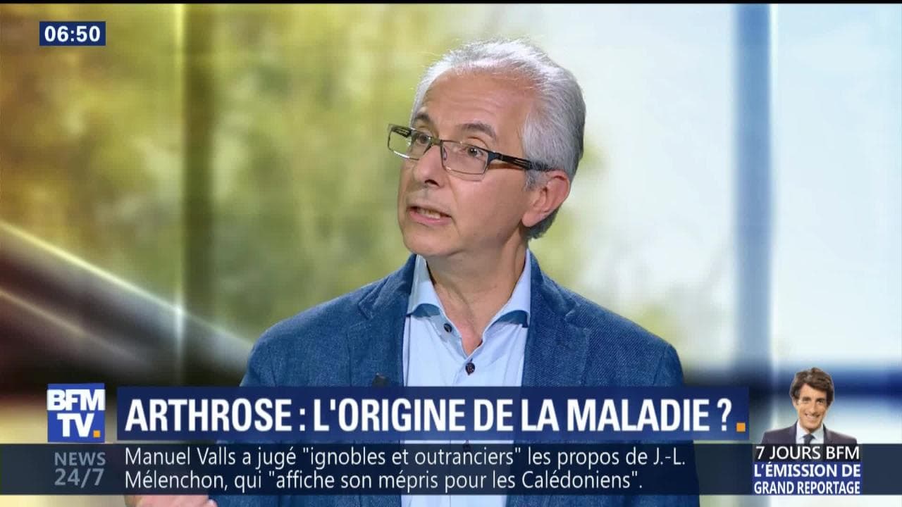 Quelle est l'origine de l'arthrose ? - 07/10