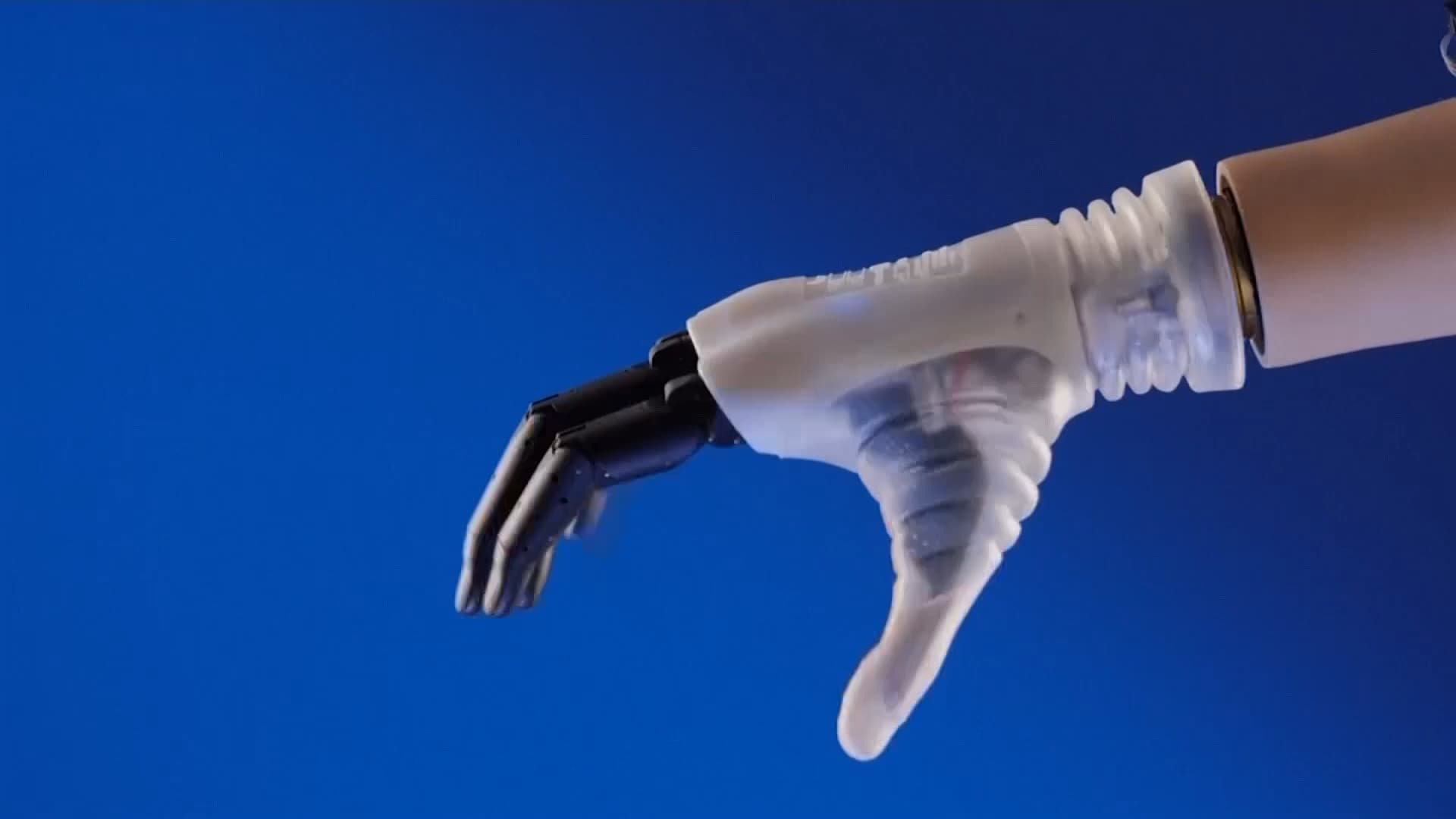 Cette prothèse de main robotisée étonne par son réalisme