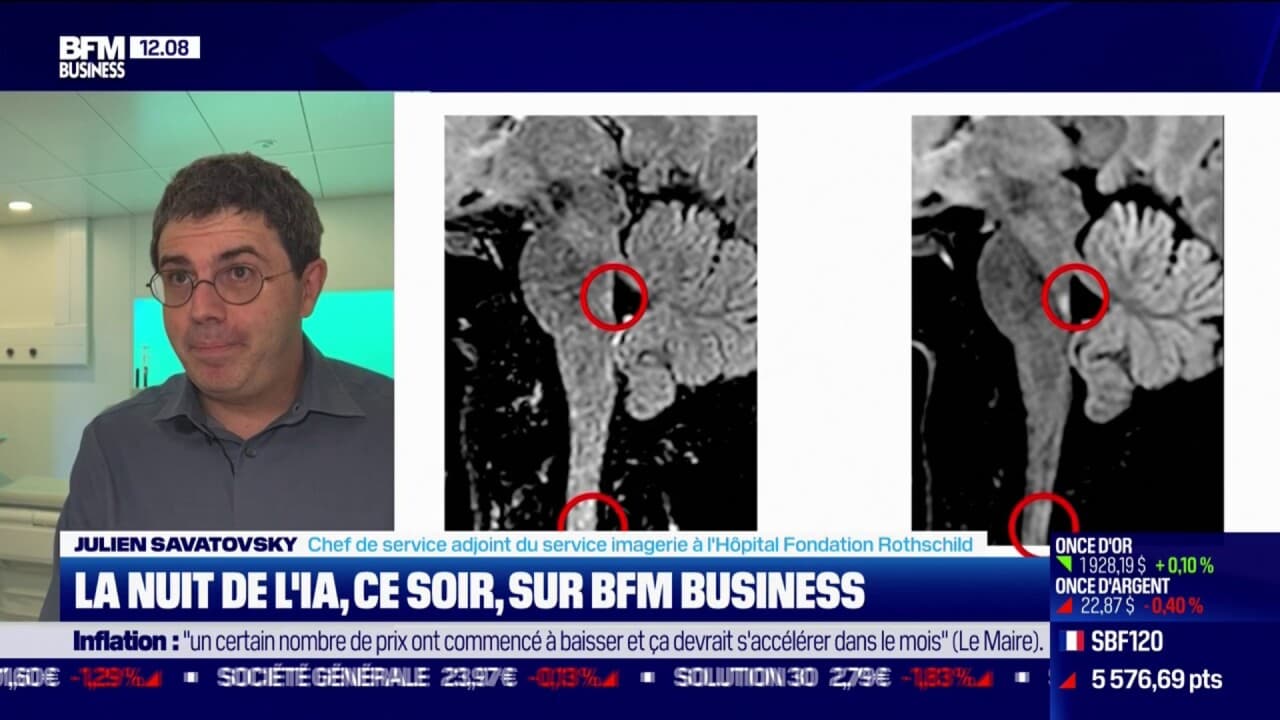 Les diagnostics des radiologues sont désormais affinés par l'IA