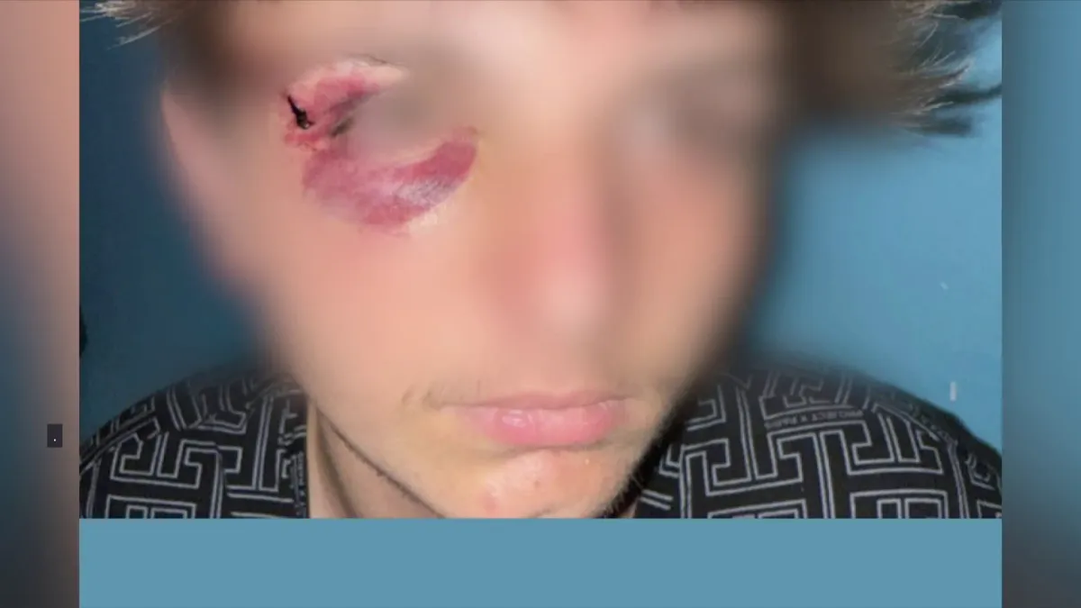 "Ils étaient une dizaine": Paul, victime d'une agression homophobe, a "peur de sortir" de chez lui