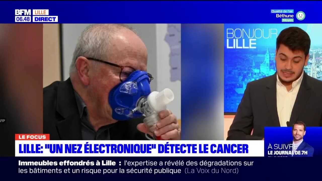 Lille: "un nez électronique" pour détecter le cancer broncho-pulmonaire