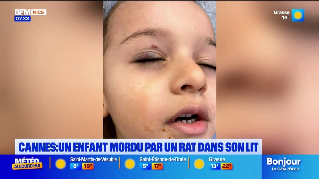 Cannes: un enfant mordu par un rat dans son lit