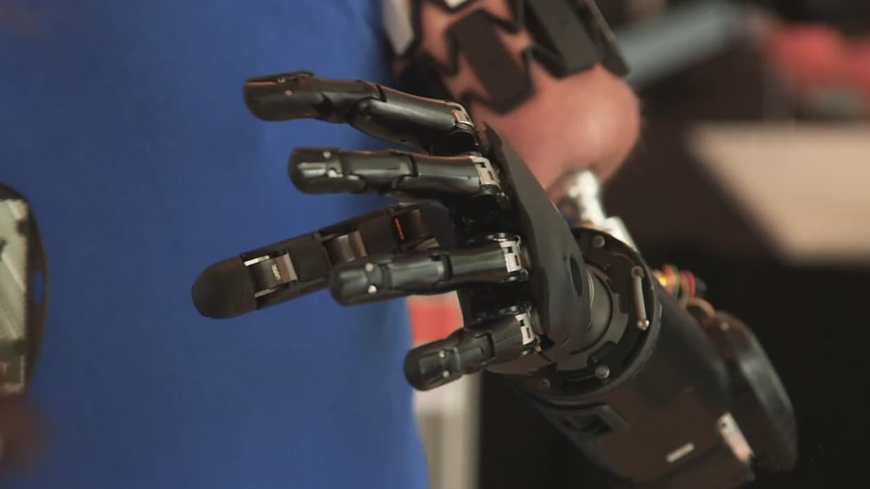 Cette prothèse de bras se contrôle par la pensée