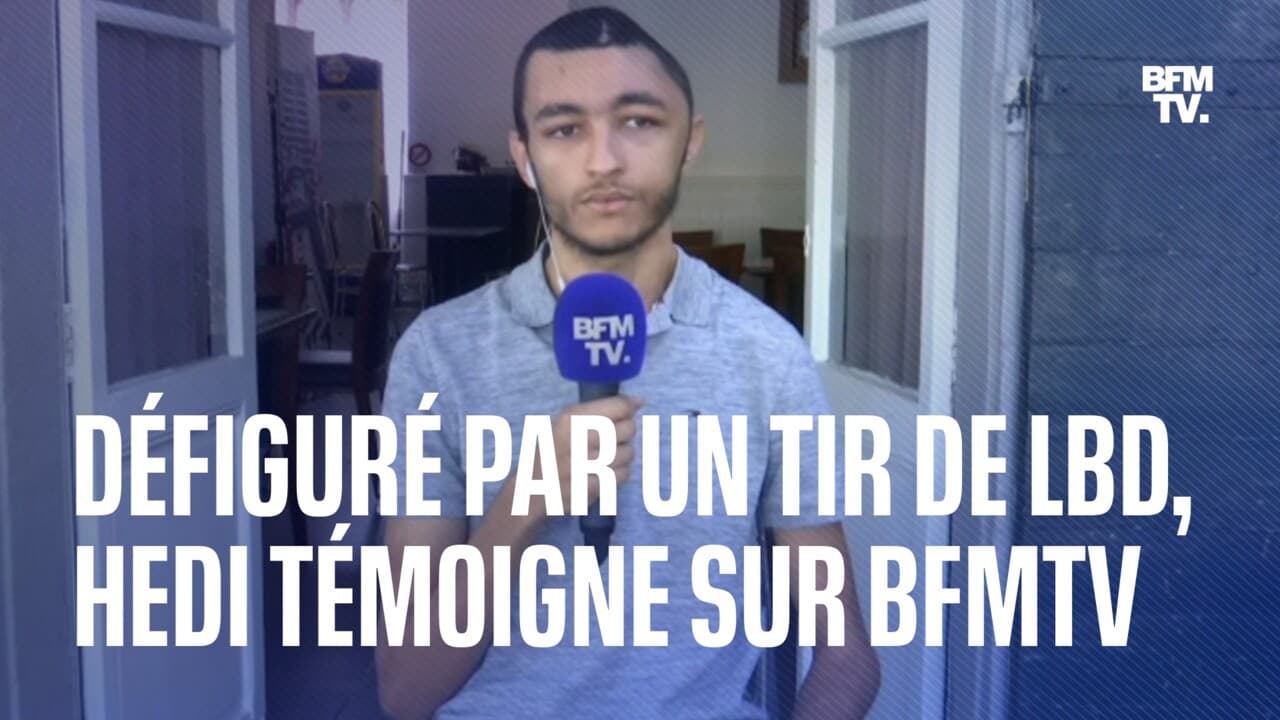 En Aucun Cas Je Ne Faisais Partie Des émeutes Hedi Défiguré Par Un Tir De Lbd Témoigne