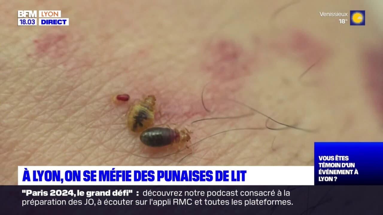 A Lyon, on se méfie des punaises de lit