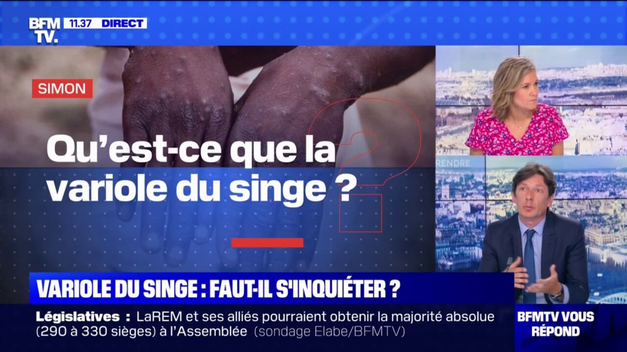 Qu'est-ce que la variole du singe ? BFMTV répond à vos questions