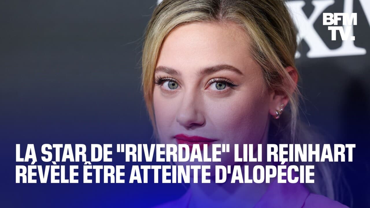 La star de “Riverdale” Lili Reinhart révèle être atteinte d’alopécie