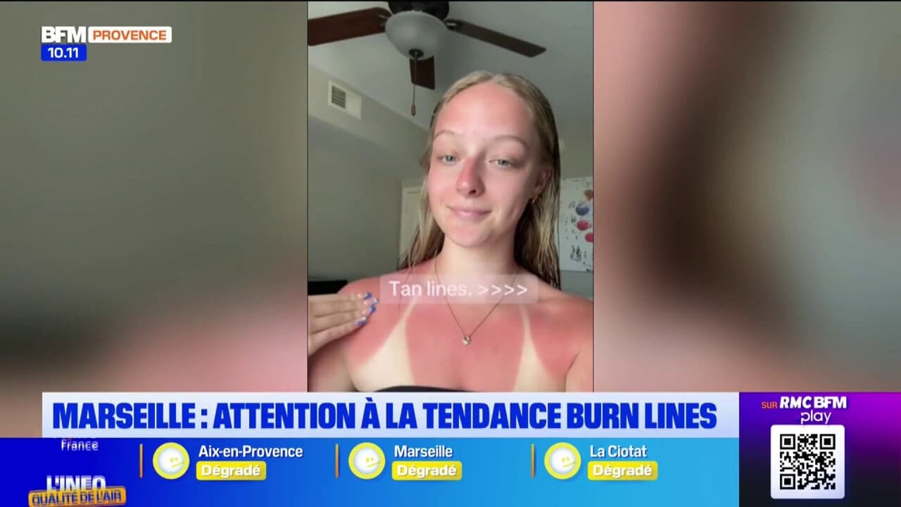 Marseille : attention à la tendance burn lines