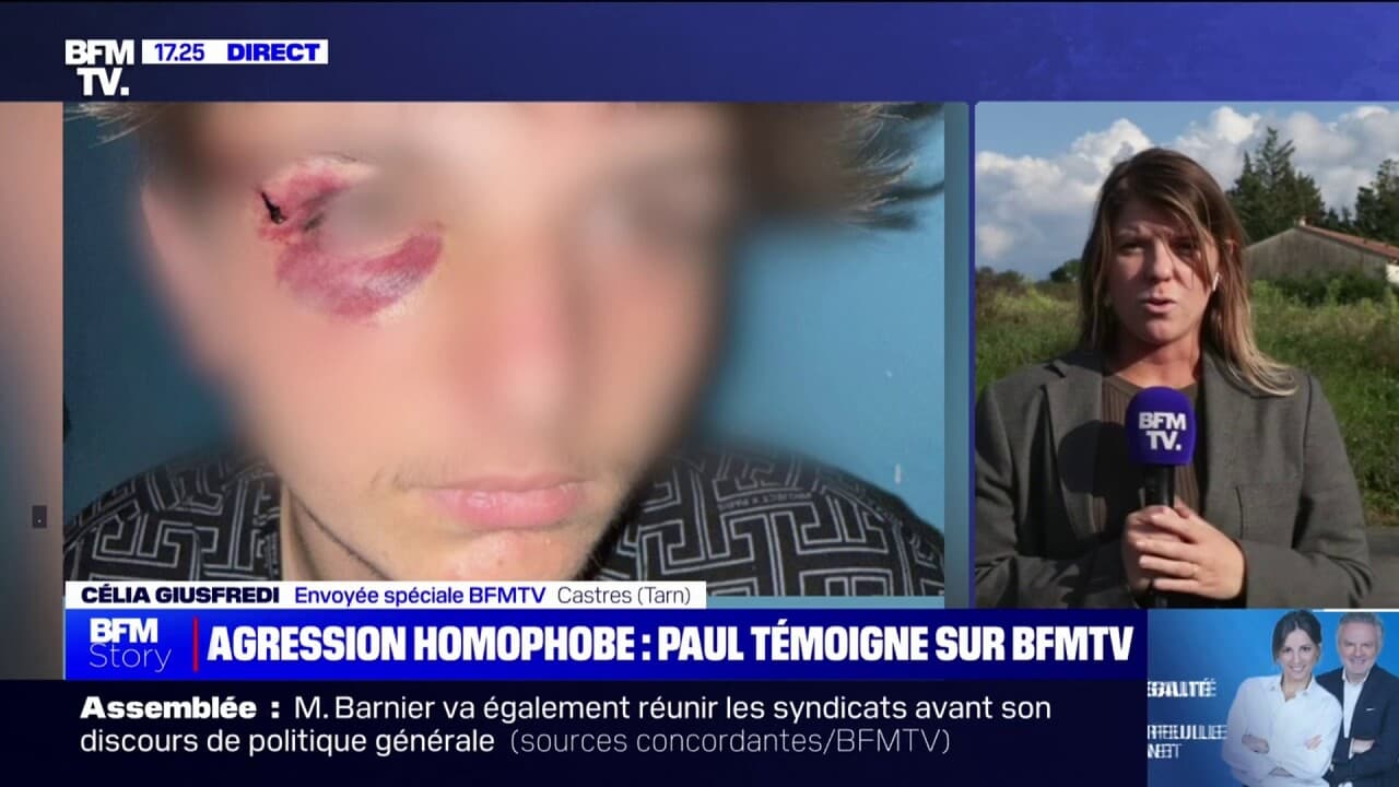 "Ils étaient une dizaine": Un adolescent de 17 ans victime d'une agression homophobe dans le Tarn