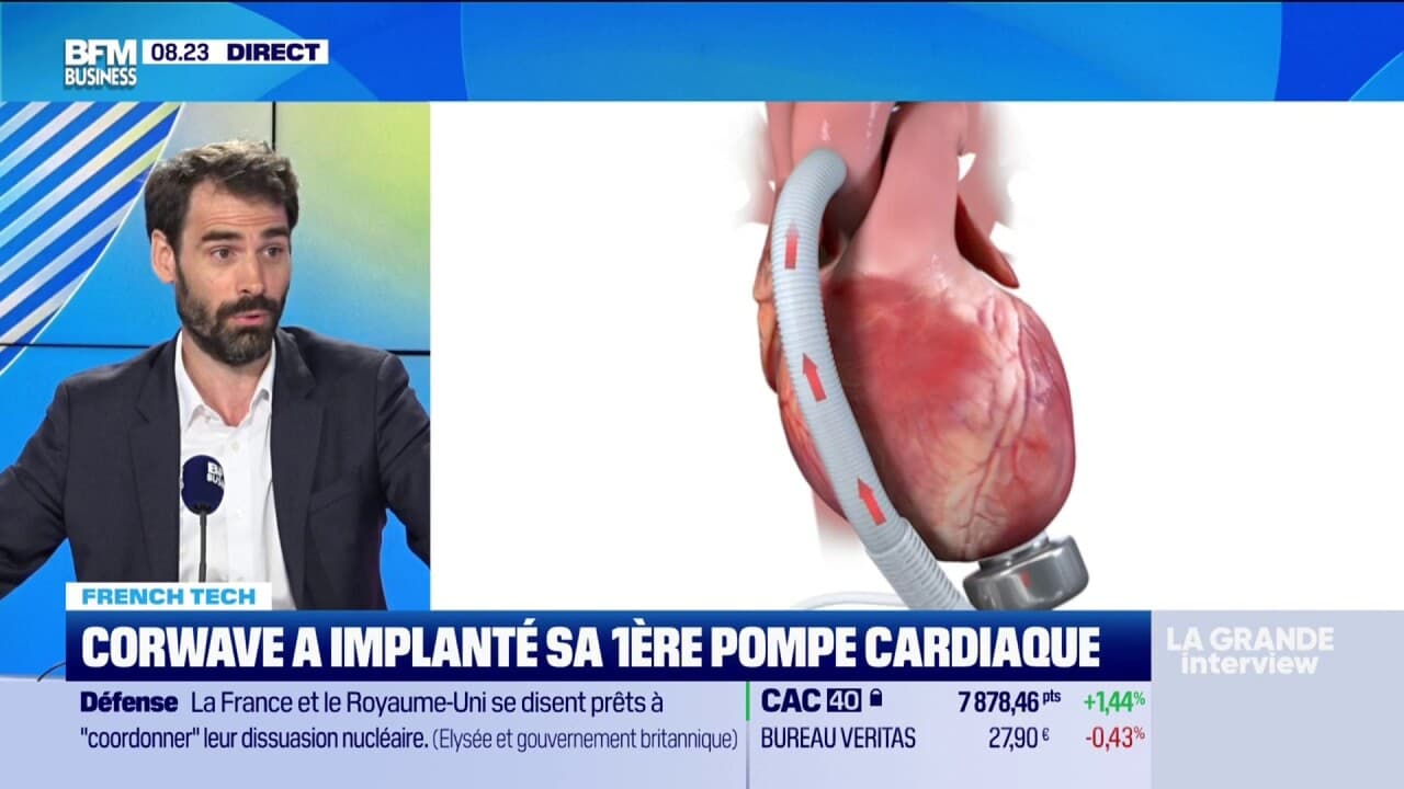 Corwave a implanté sa 1ère pompe cardiaque