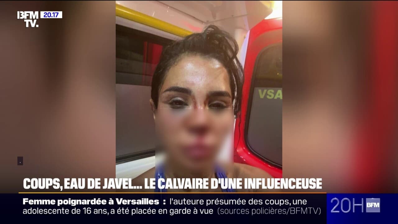 Coups, eau de javel... Le calvaire d'une influenceuse, Soraya Riffi ...