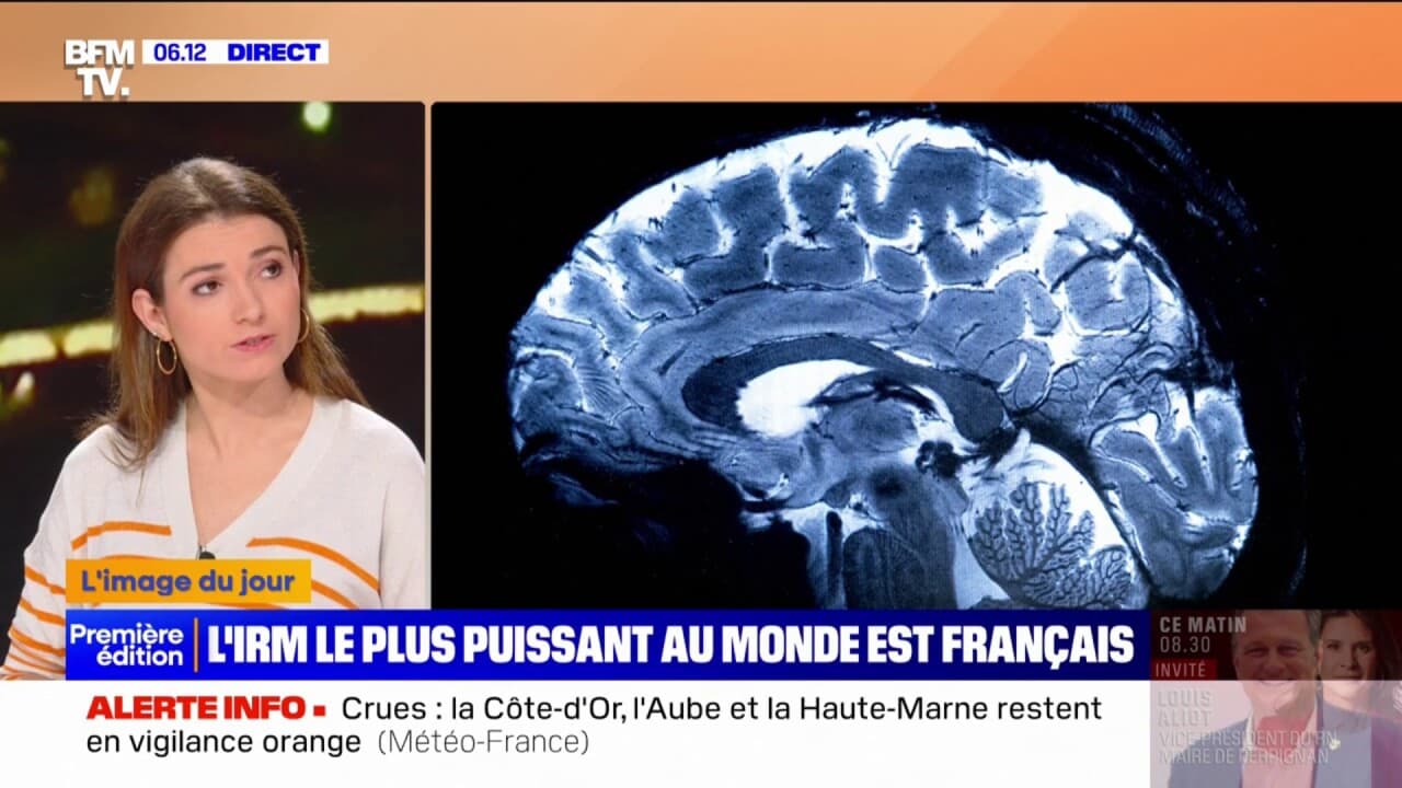 Le cerveau comme vous ne l'avez jamais vu: l'IRM la plus puissante au monde a été dévoilée