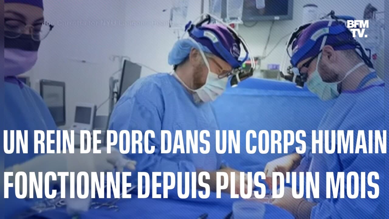 Un rein de porc transplanté dans un corps humain fonctionne depuis plus ...