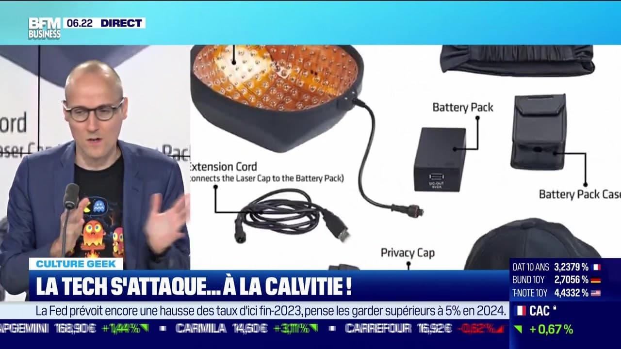 Culture Geek : La tech s'attaque... à la calvitie !, par Anthony Morel - 21/09