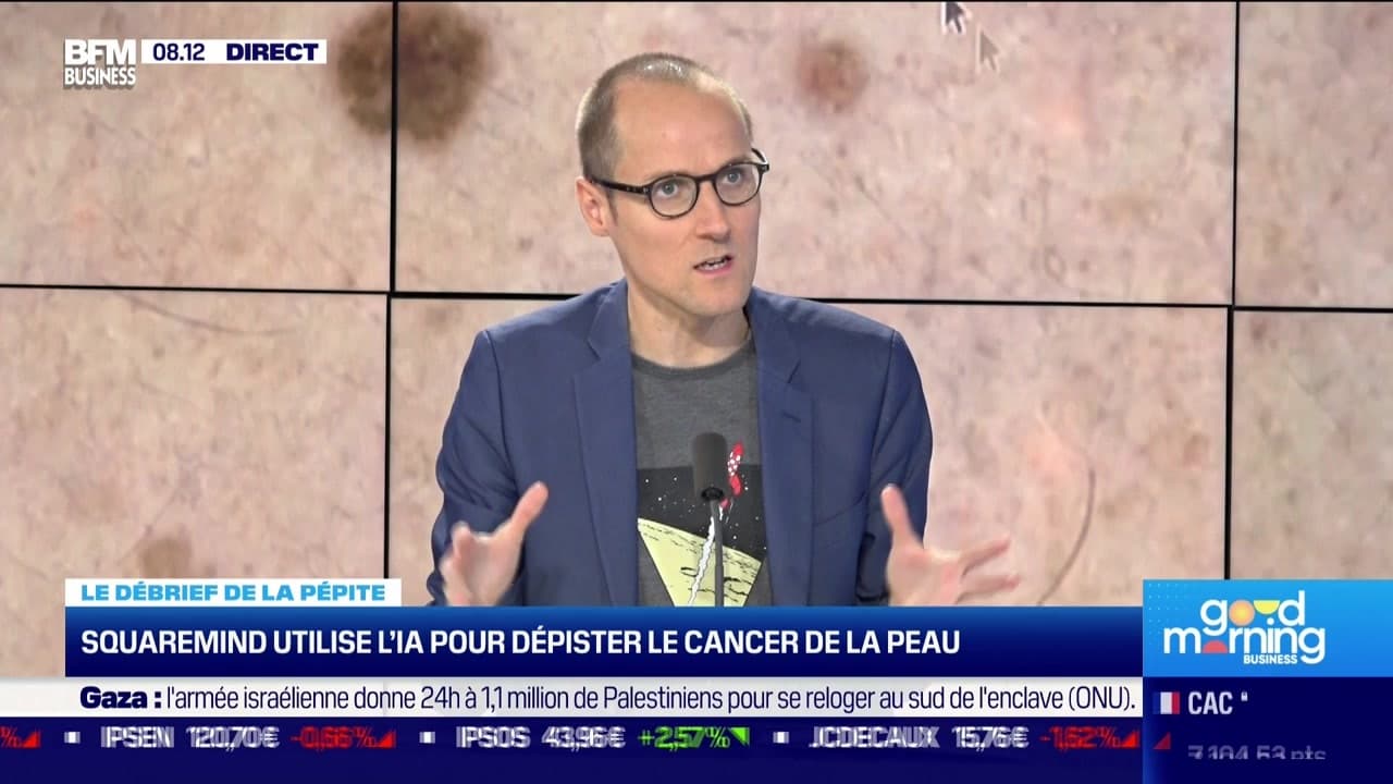 Culture Geek : SquareMind utilise l'IA pour dépister les cancers de la peau, par Anthony Morel ...