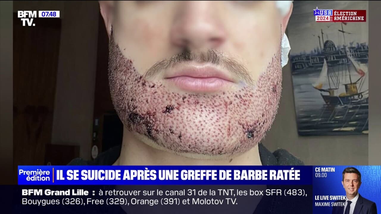 "Il souffrait, il avait mal, il ne dormait plus": Mathieu, 24 ans, s ...