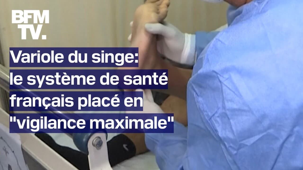 Variole du singe: le système de santé français placé en "vigilance ...