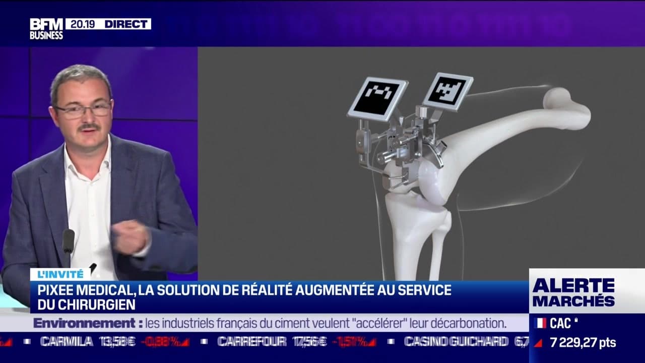 Sébastien Henry (Pixee Medical) : Pixee Medical, la solution de réalité ...