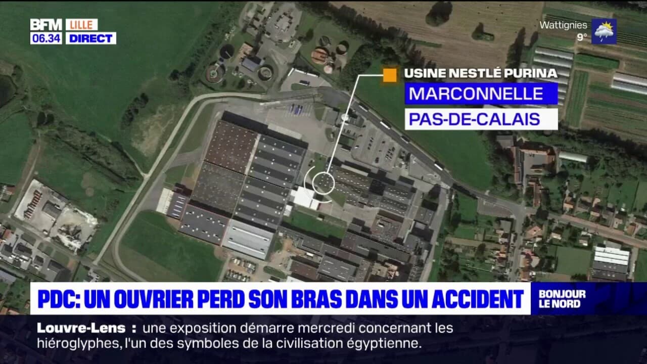 Pas-de-Calais: un ouvrier perd son bras après un accident du travail ... Pas-de-Calais: un ouvrier perd son bras après un accident du travail ...