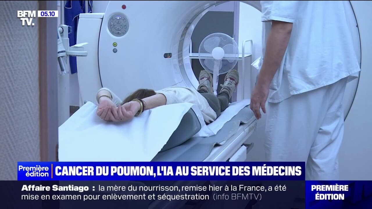 Cancer du poumon: comment l'IA pourrait aider les médecins à mieux ...