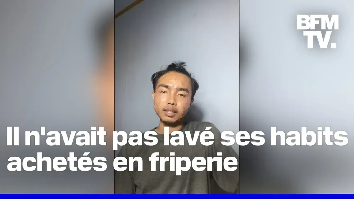 Ce tiktokteur contracte une maladie cutanée, le molluscum contagiosum ...