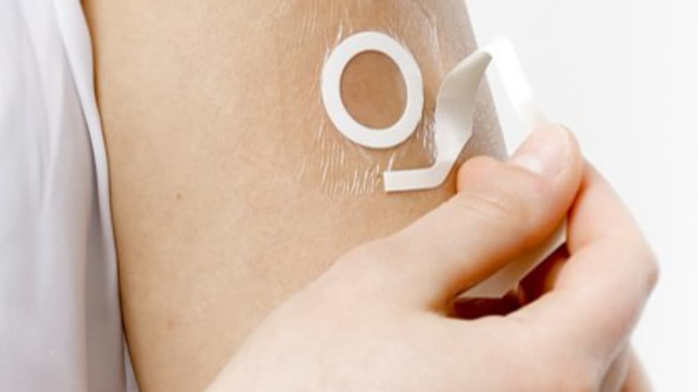 Patch anti-allergies: comment fonctionne cette prometteuse invention ...