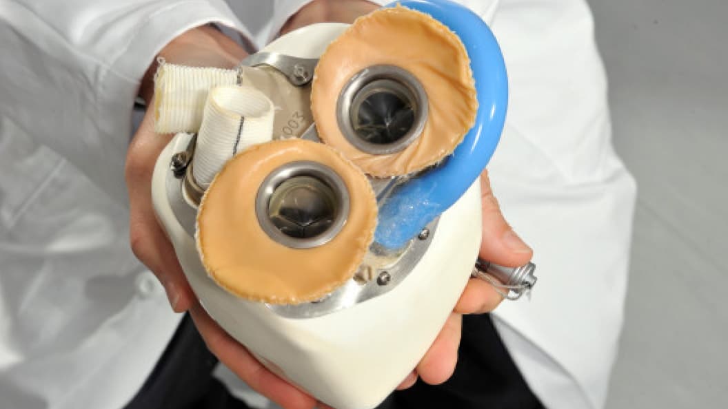 Le coeur artificiel de Carmat en route vers la commercialisation